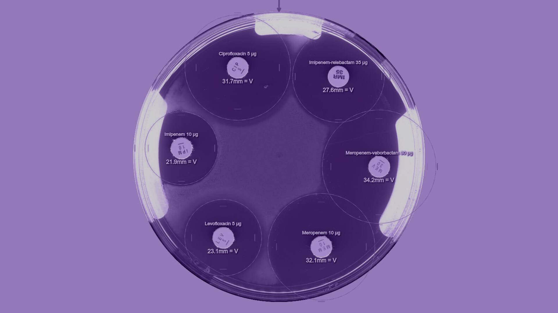 Antibiograma – de la laborator la decizia clinică. Curs complet în 6 ...